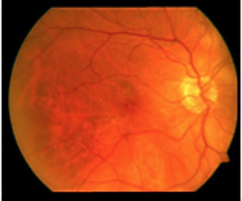 Artificial Intelligence: Reshaping AMD Management