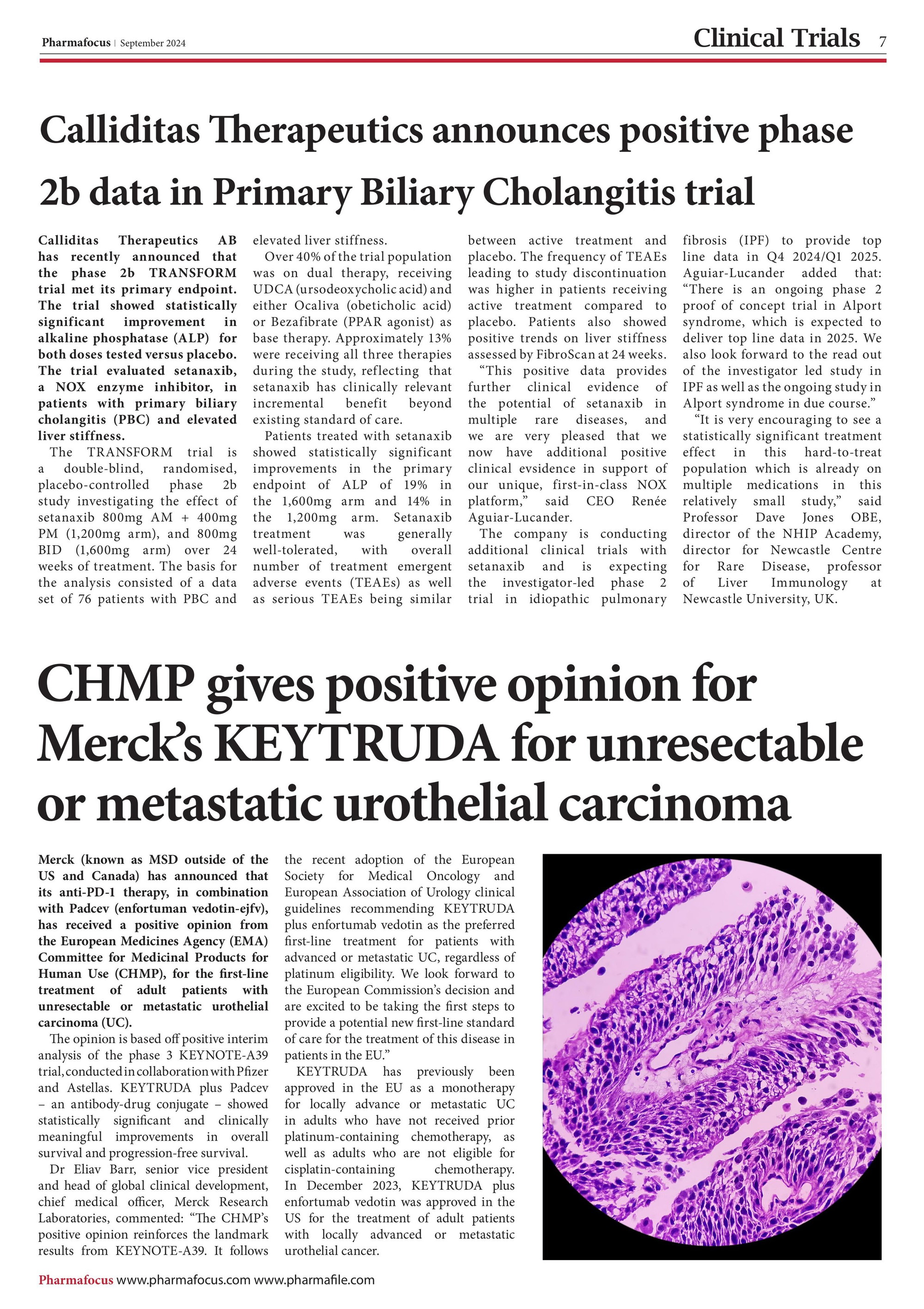 Calliditas Therapeutics announces positive phase 2b data in Primary ...