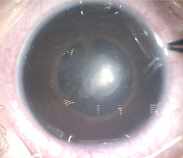 Awareness Building in Community Settings