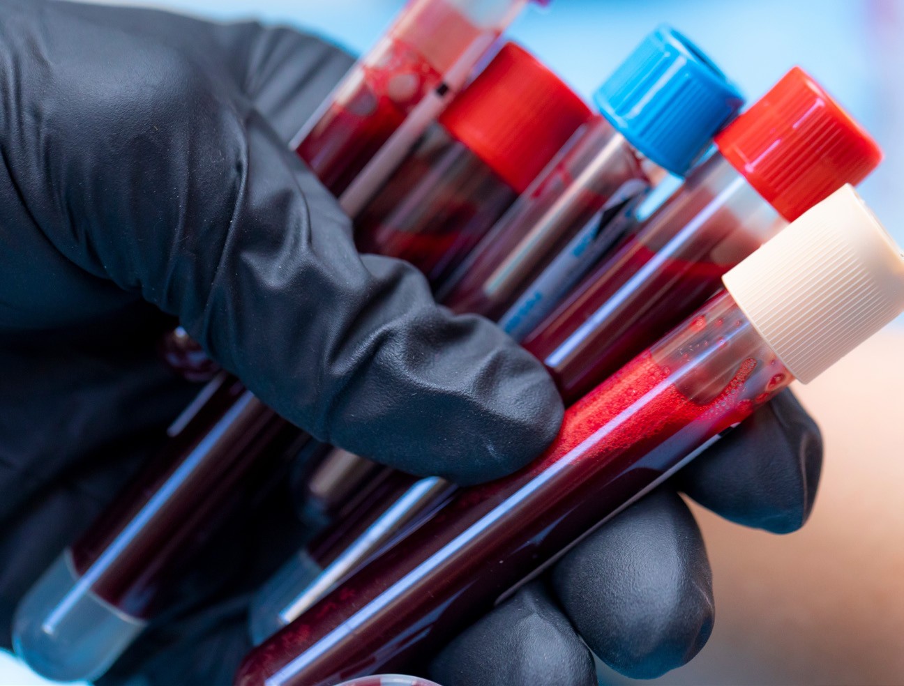 MHRA approves new treatment combo for transplant-ineligible multiple ...