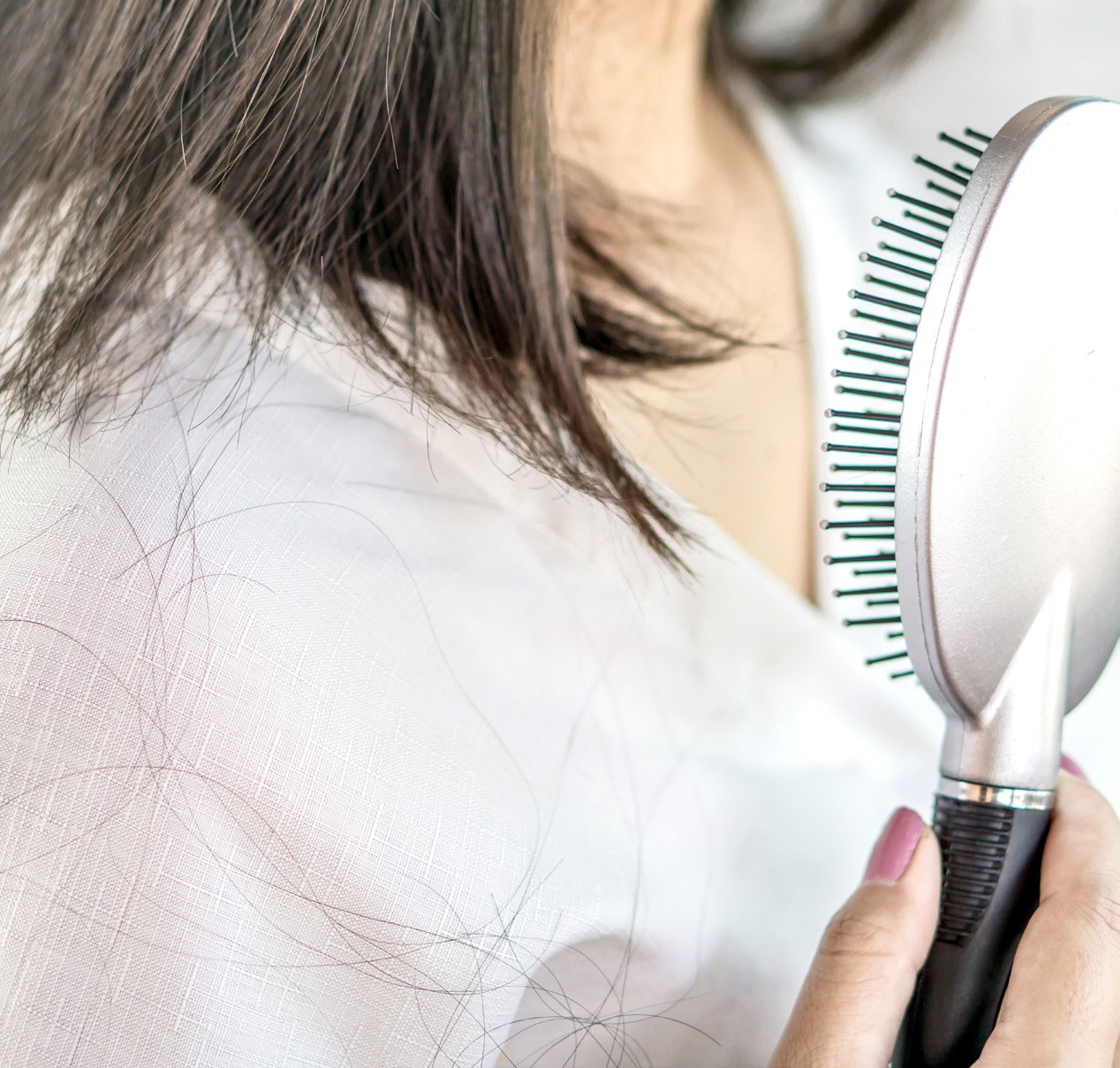 Clinical registry for adolescent alopecia areata launched by Thermo ...