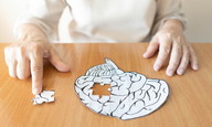 TauRx builds on its Alzheimer’s momentum after tablet found to slow ...