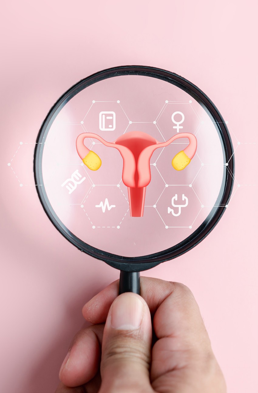 Corcept’s relacorilant improves ovarian cancer survival in phase 3 trial