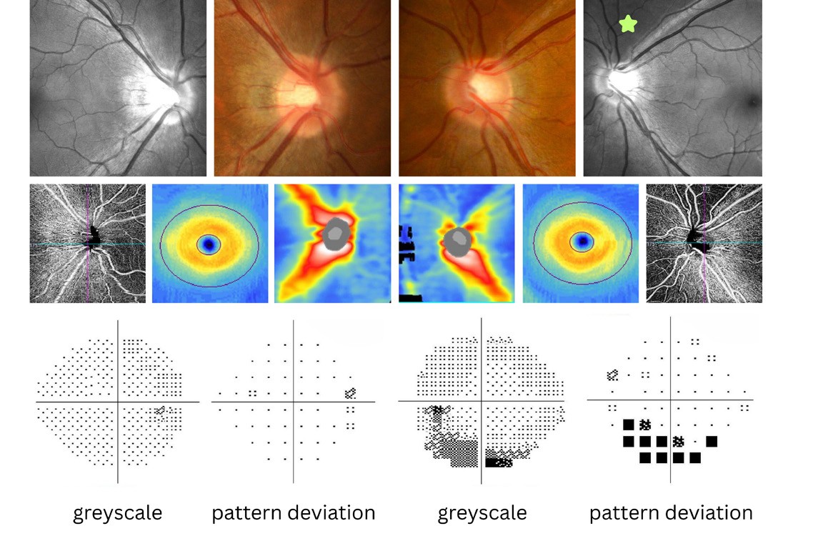 When Half a Disc Tells All