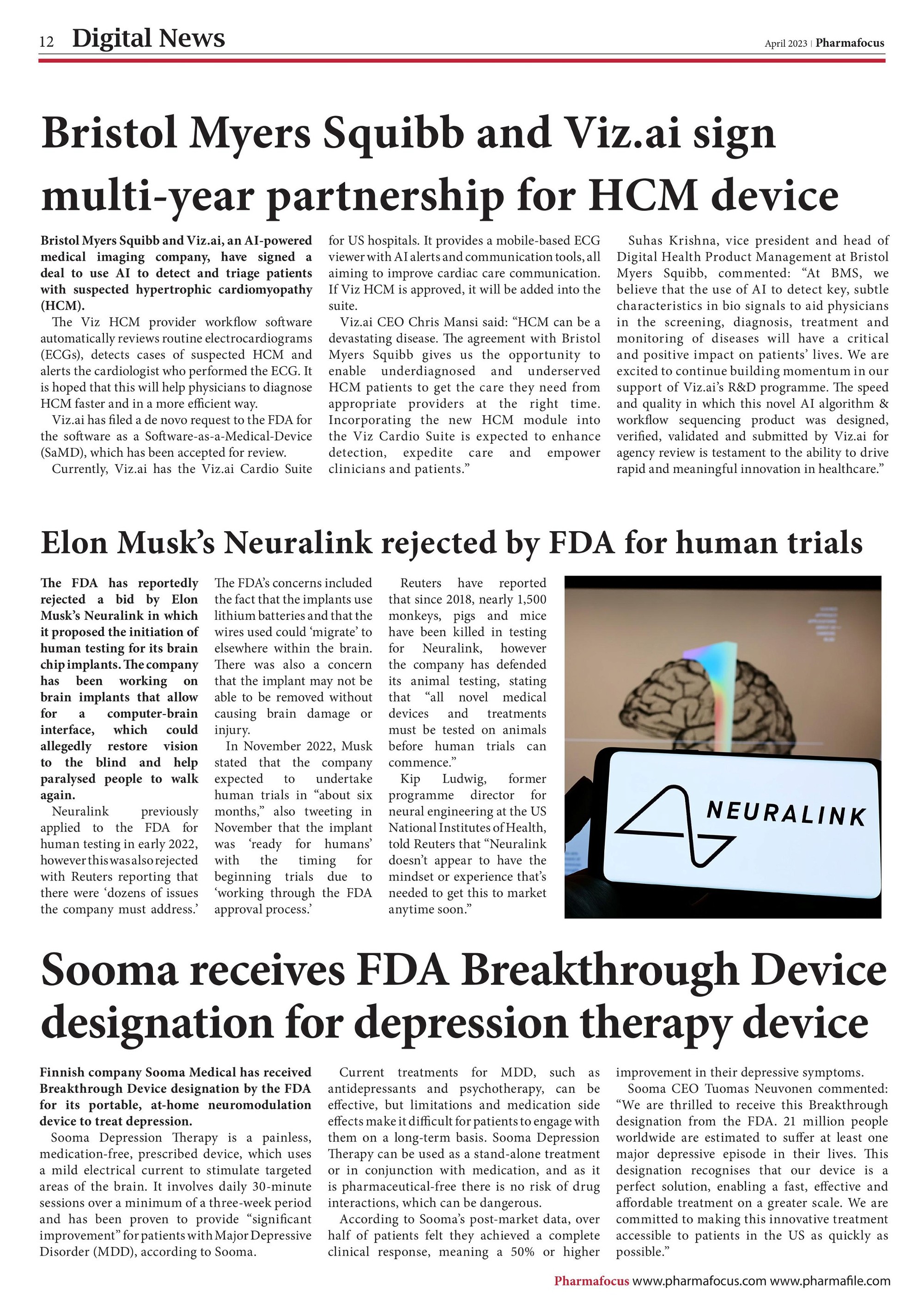 Sooma receives FDA Breakthrough Device designation for depression ...
