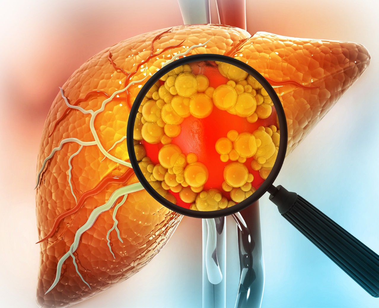 Merck’s relapsing multiple sclerosis trial put on FDA partial clinical ...