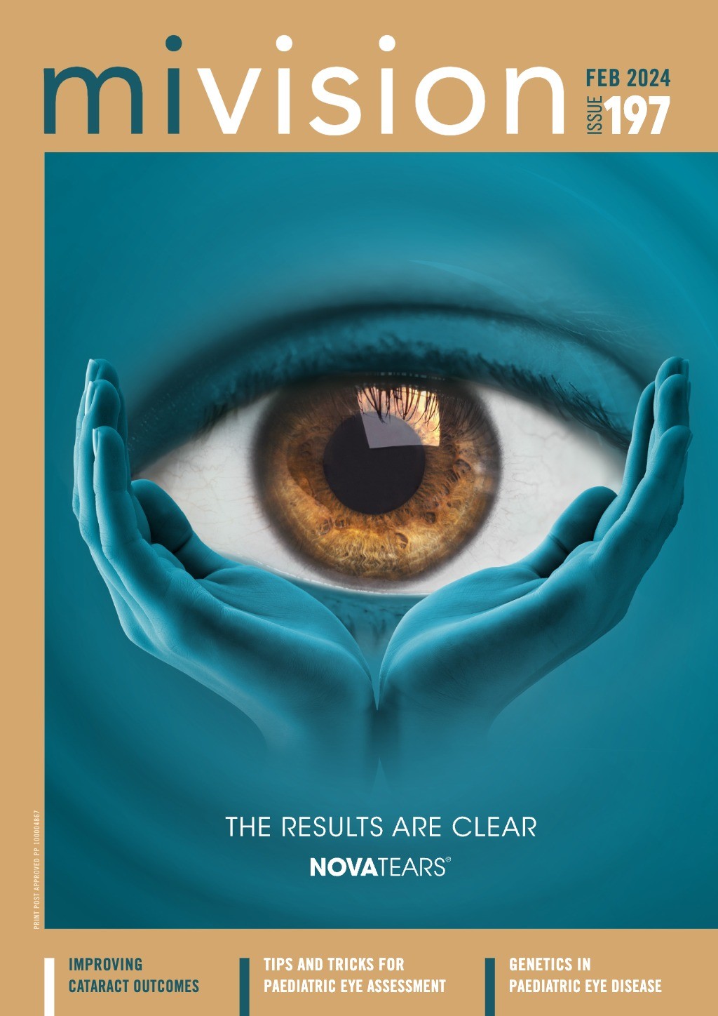 mivision Magazine February 2024